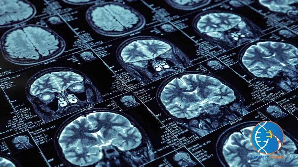 What Is Vinpocetine? Dosage, Safety and 5 Brain Benefits